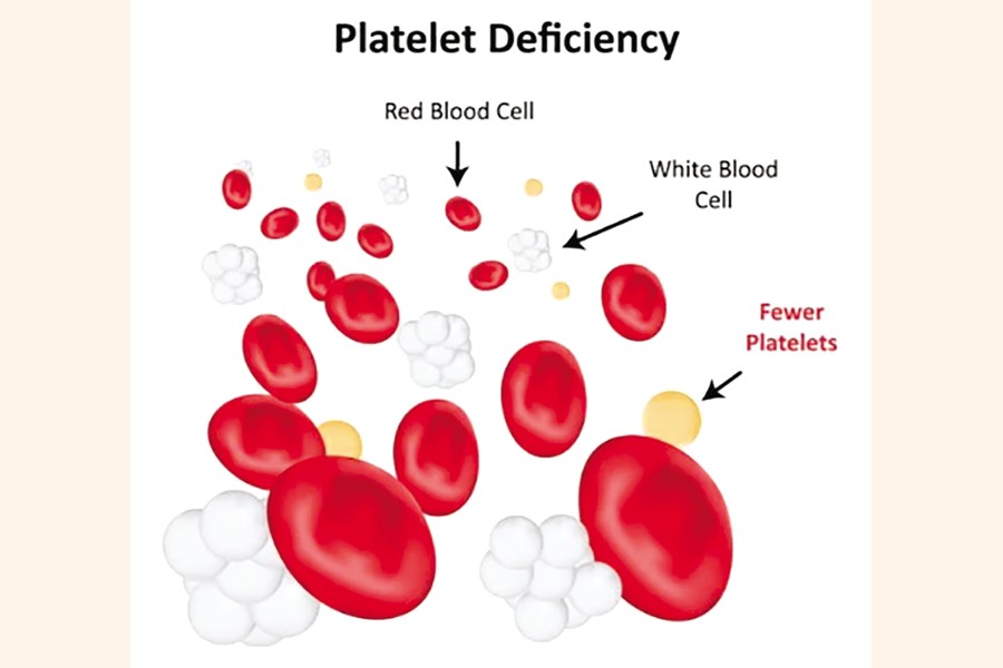 Why does the platelet count decrease? | The Financial Express